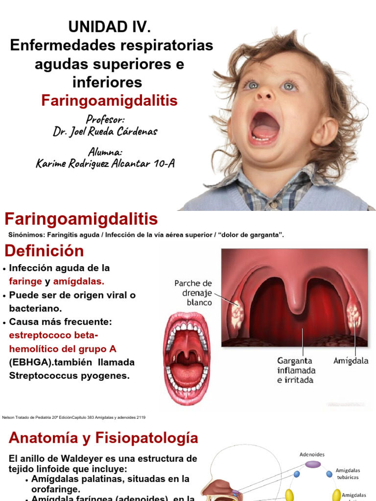 Faringoamigdalitis PDF | PDF | Enfermedades y trastornos humanos ...