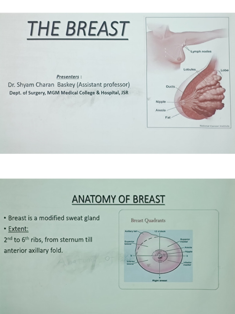 Breast 30-05-24 DR S C Baskey Sir | PDF