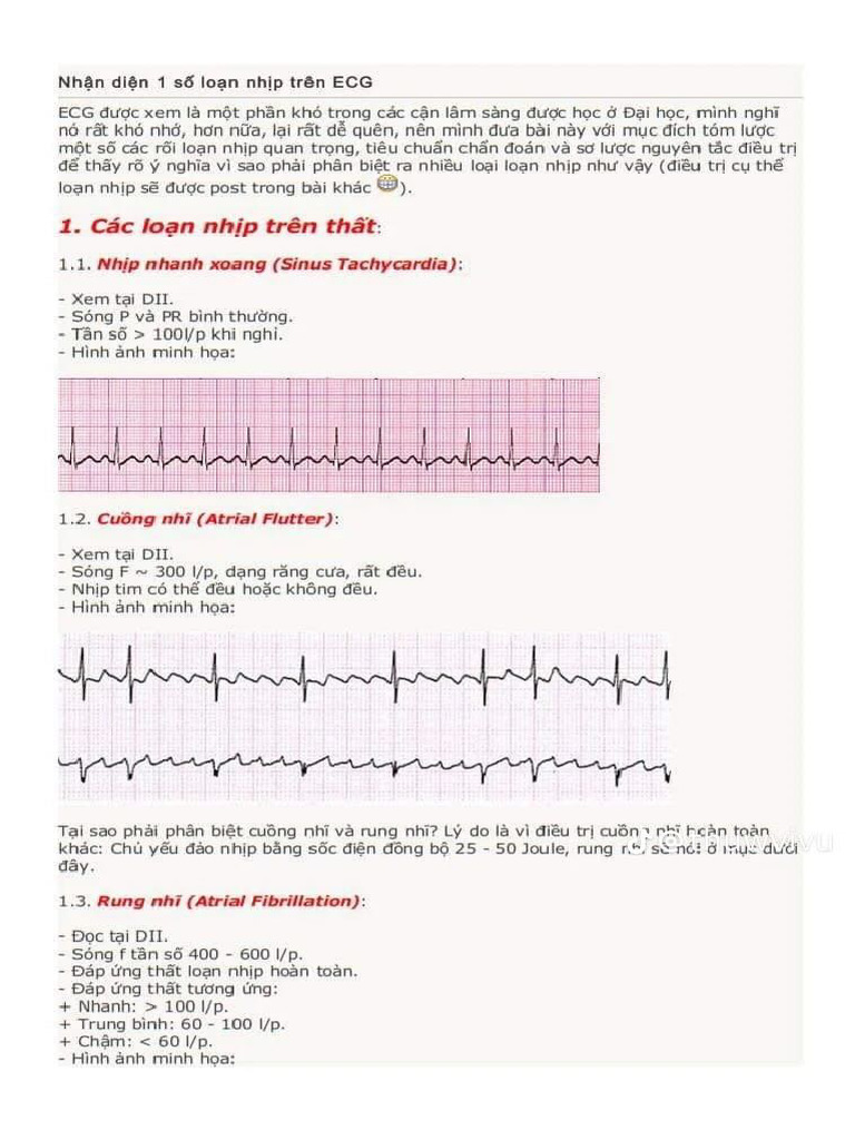 ECG | PDF