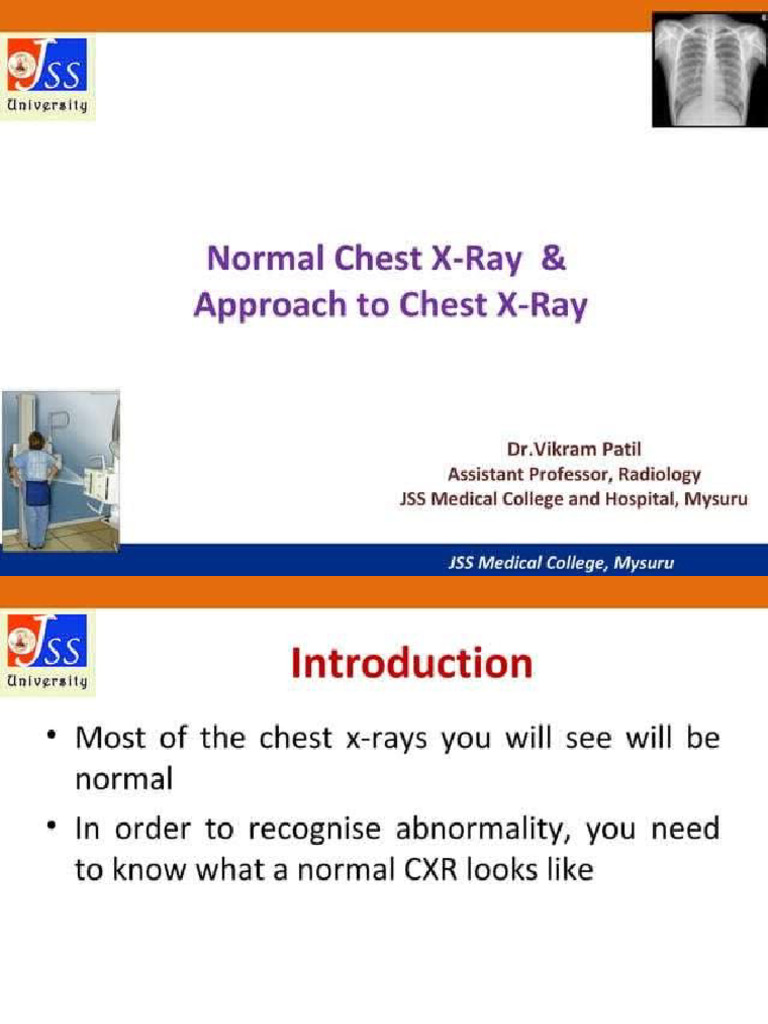 Chest X Ray | PDF