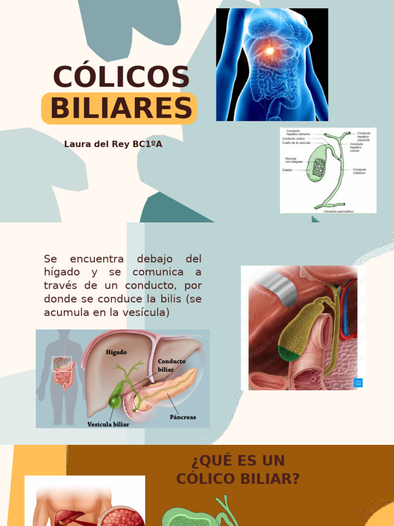 Cólico Biliar: Síntomas y Tratamientos | PDF | Bilis | Vesícula biliar
