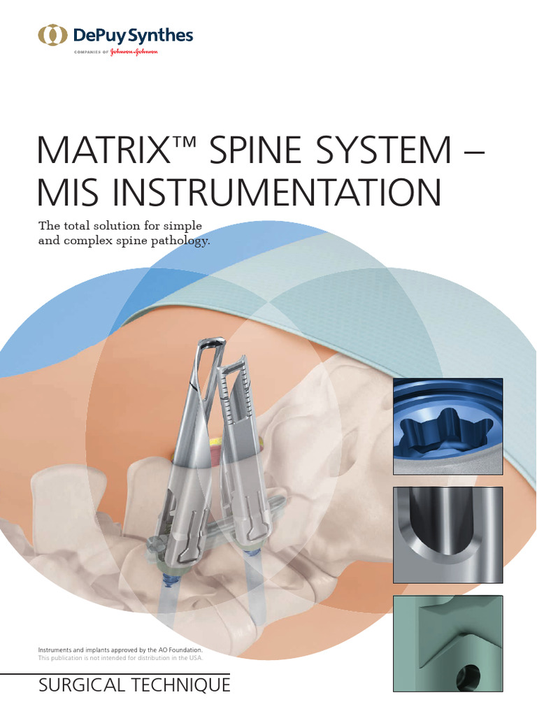 Surgical Technique - Spine Sistem MATRIX MIS Isntrumentation PDF | PDF ...
