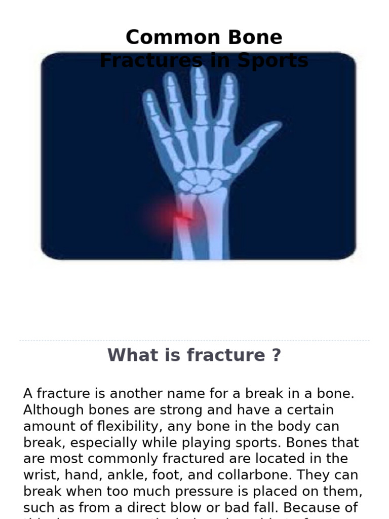 Bone Fractures in Sports | PDF | Bone | Clinical Medicine