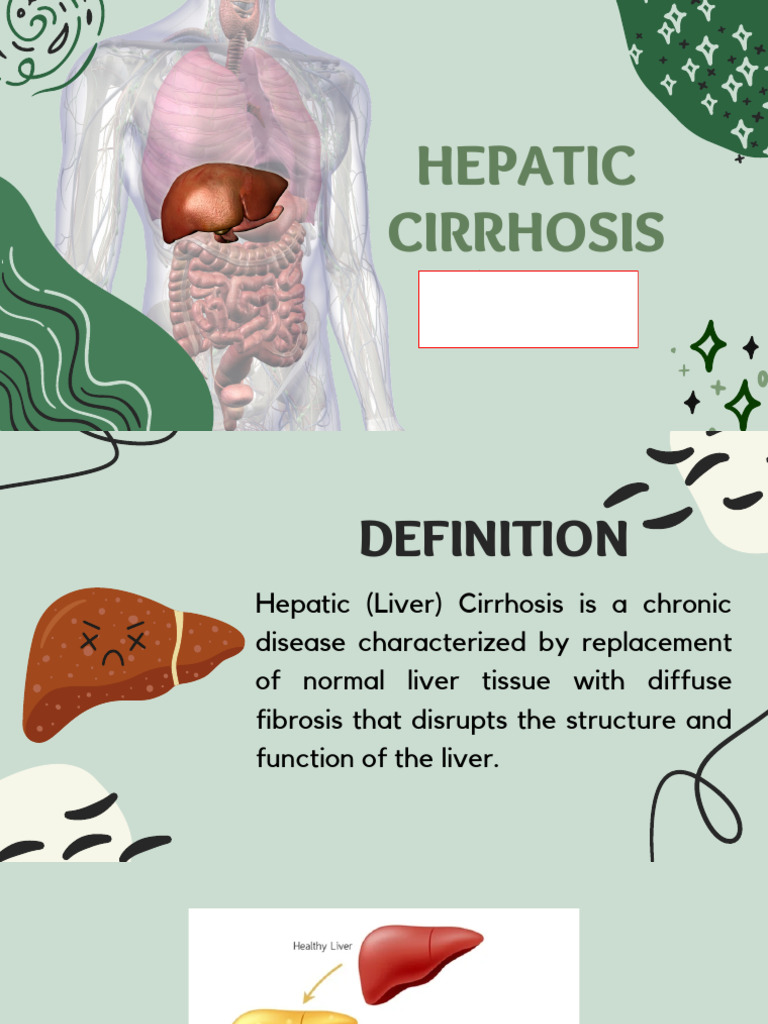 Hepatic Liver Cirrhosis | PDF | Cirrhosis | Liver