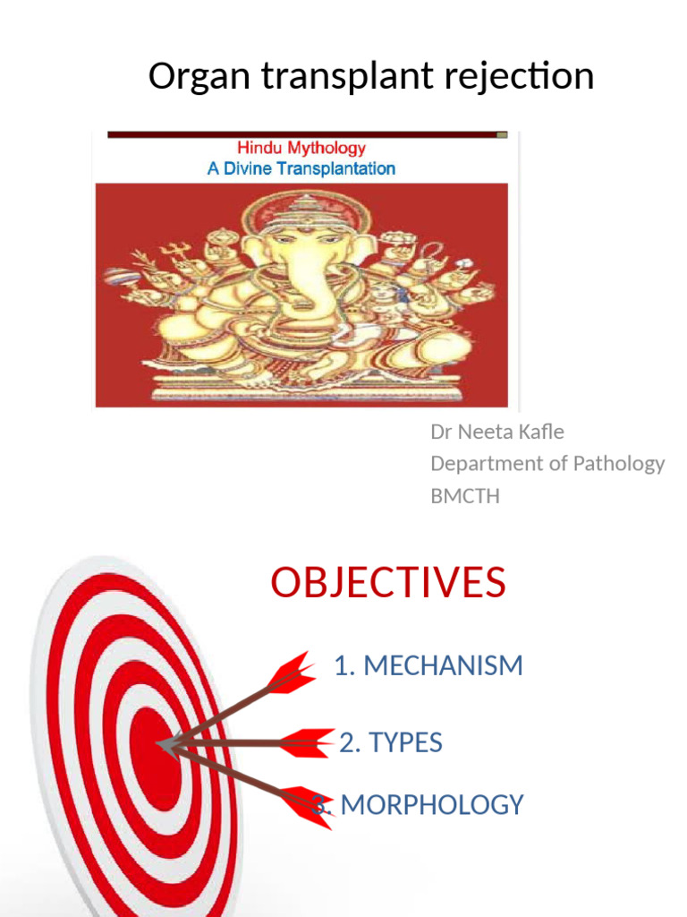 Understanding Organ Transplant Rejection | PDF | Transplant Rejection ...