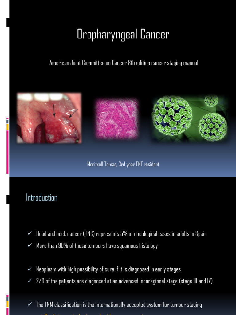 Squamous Carcinoma Oropharynx II | PDF | Neck | Head And Neck Cancer