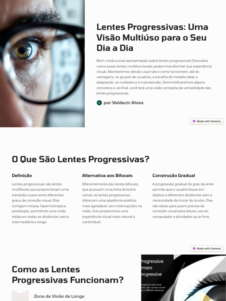 Lentes Progressivas Uma Visao Multiuso Para o Seu Dia a Dia | PDF | Visão