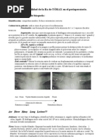 Proyecciones PA Y AP | PDF | Tórax (anatomía humana) | Anatomía