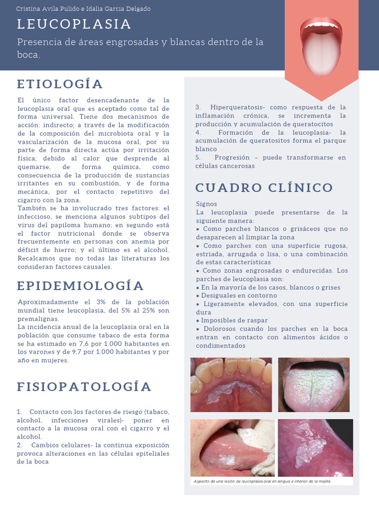Leucoplasia Oral: Causas y Tratamientos | PDF | Vitamina a | Cáncer