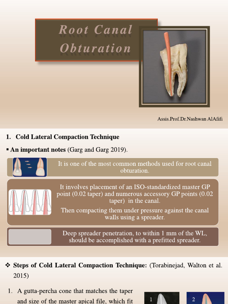 Root Canal Obturation | PDF