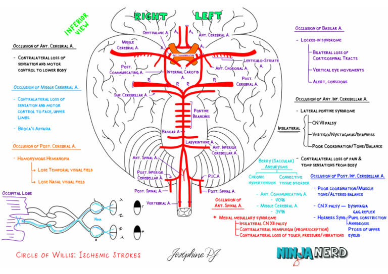Circle of Willis - Ischemic Strokes (1) Atf | PDF