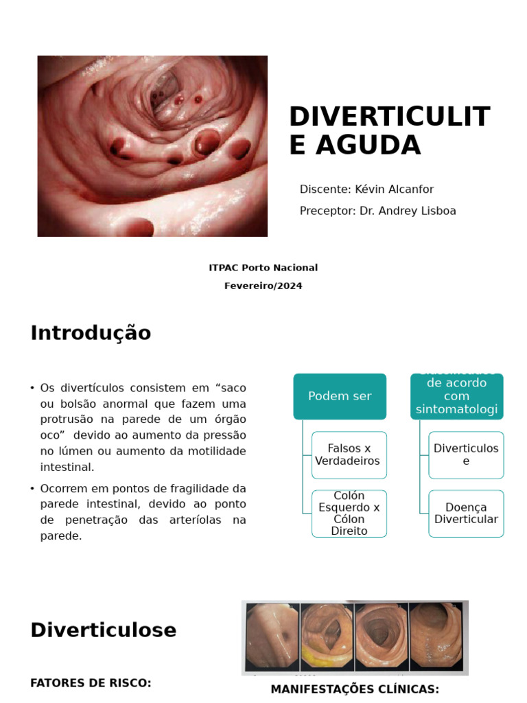 Diverticulite Aguda: Diagnóstico e Tratamento | PDF | Medicina Clínica ...