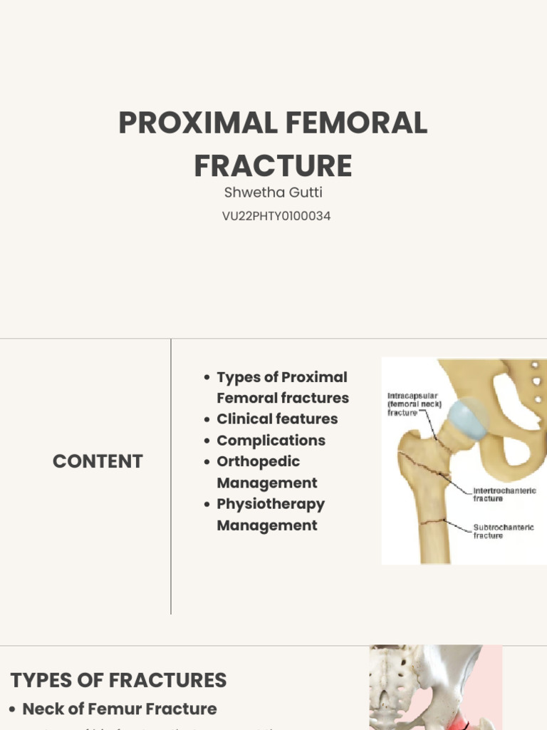 Proximal Femoral Fracture Management | PDF | Hip | Anatomical Terms Of ...