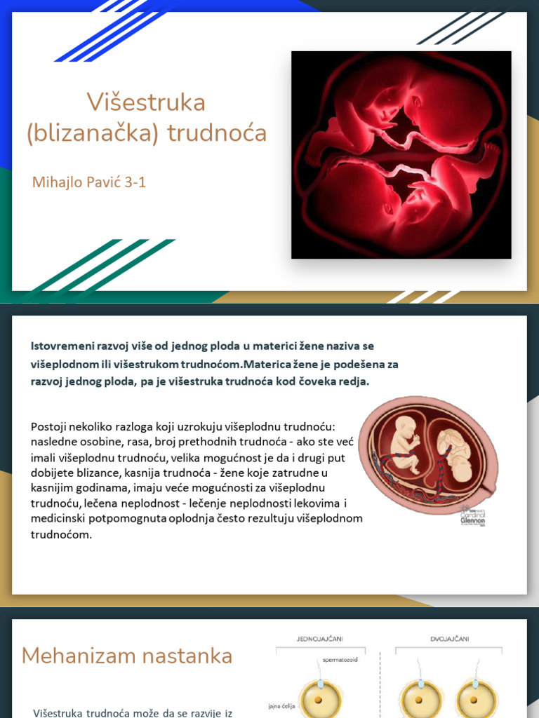Blizana - Ka Trudno - A | PDF