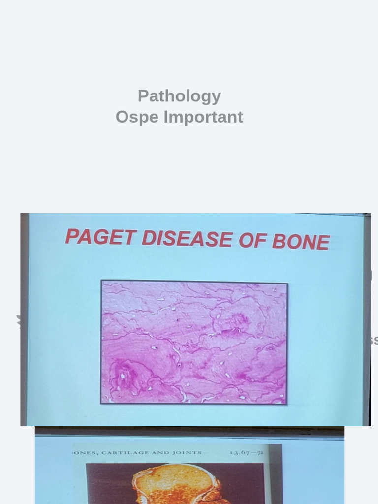 Pathology-Ospe Important | PDF