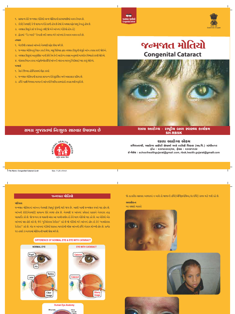 Congenital Cataract | PDF