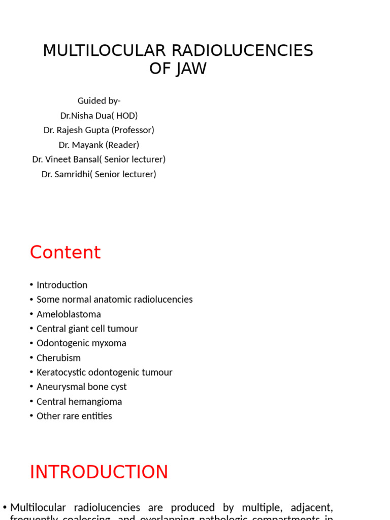 Multilocular Radiolucencies of Jaw | PDF | Diseases And Disorders ...
