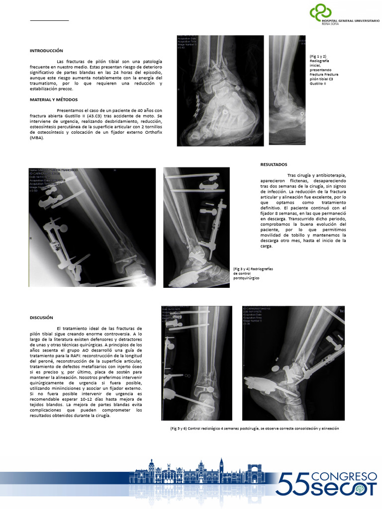 Introducción: (Fig 1 y 2) Radiografía Inicial, Presentando Fractura ...