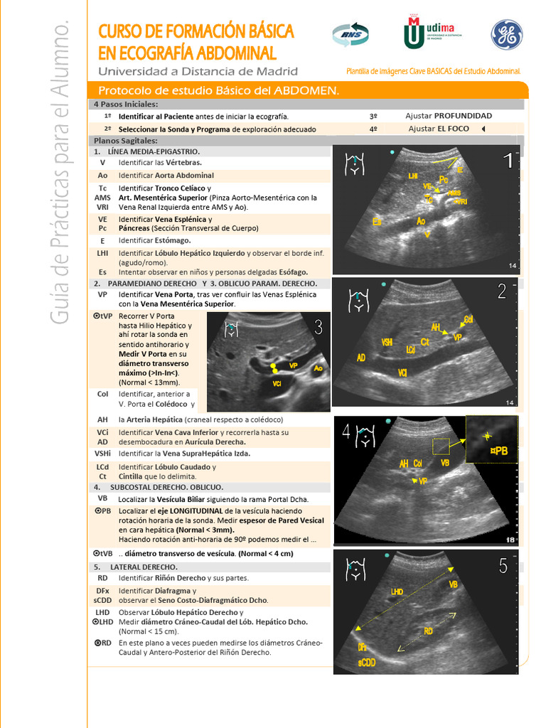 Protocolo Basico Exploracion ECO Abdomen | PDF | Abdomen | Angiología