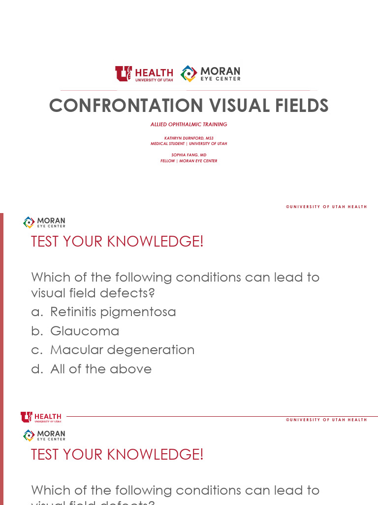 Confrontational Visual Fields | PDF | Retina | Visual Perception