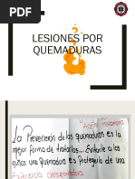 Regla de los 9 en Quemaduras | PDF | Quemar | Enfermedades y trastornos ...
