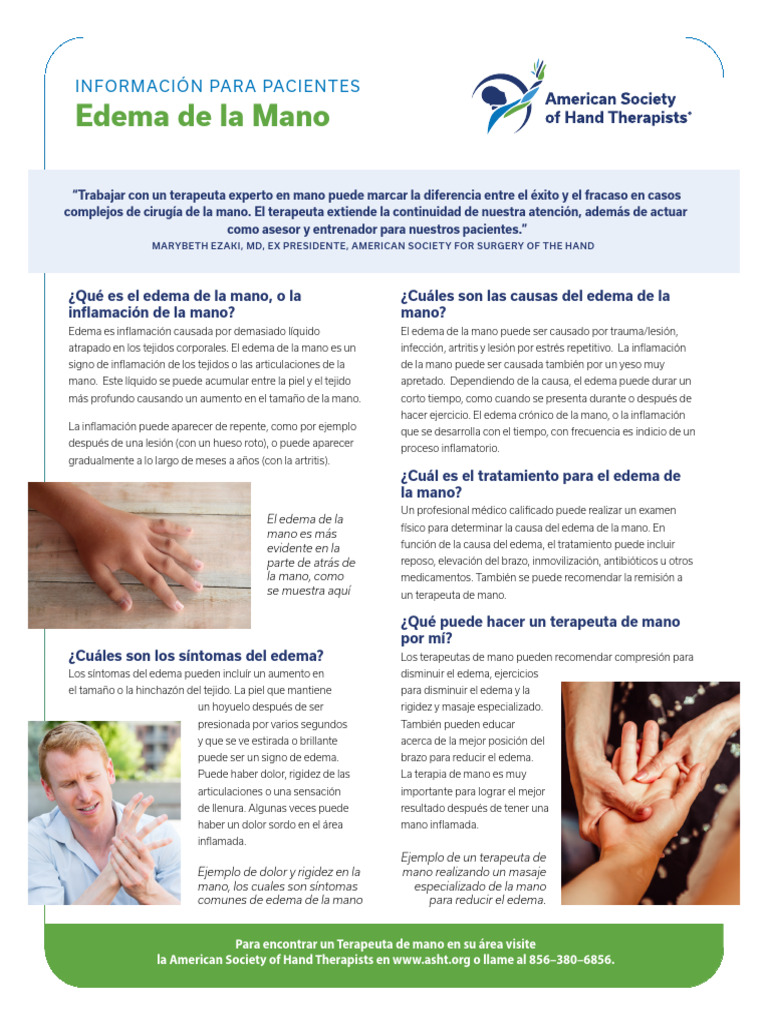 Edema de la Mano: Causas y Tratamientos | PDF | Edema | Inflamación