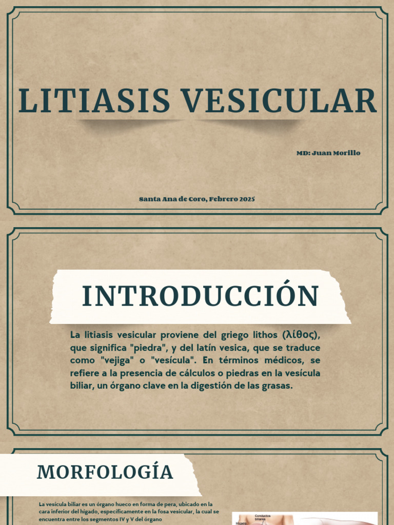 Litiasis Vesicular MD Juan Morillo | PDF | Vesícula biliar | Bilis