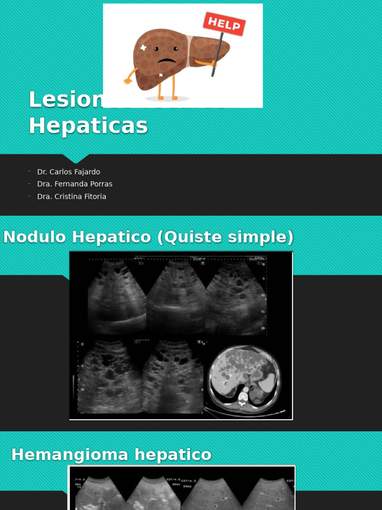 Grupo 1 Descripcion de Lesiones Hepaticas | PDF