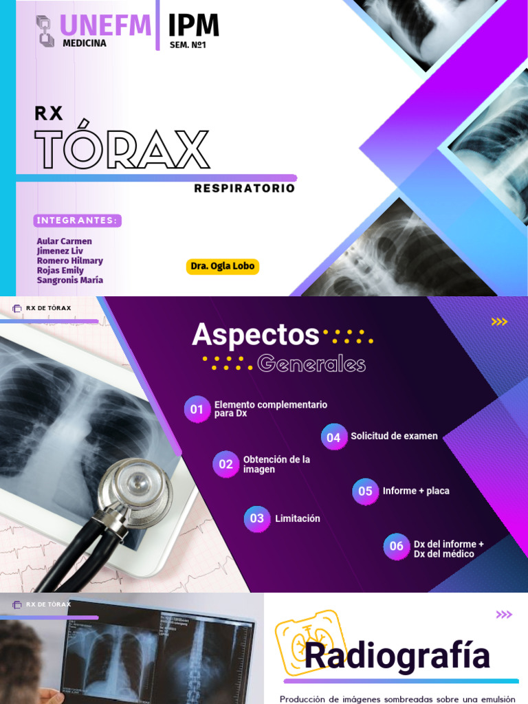 Guía Completa de RX de Tórax | PDF | Tórax | Pulmón