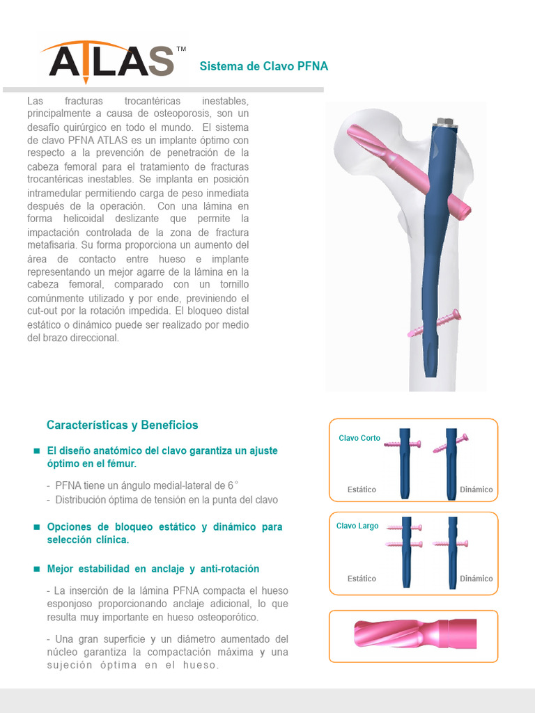 Sistema de Clavo PFNA: Beneficios y Usos | PDF | Hueso