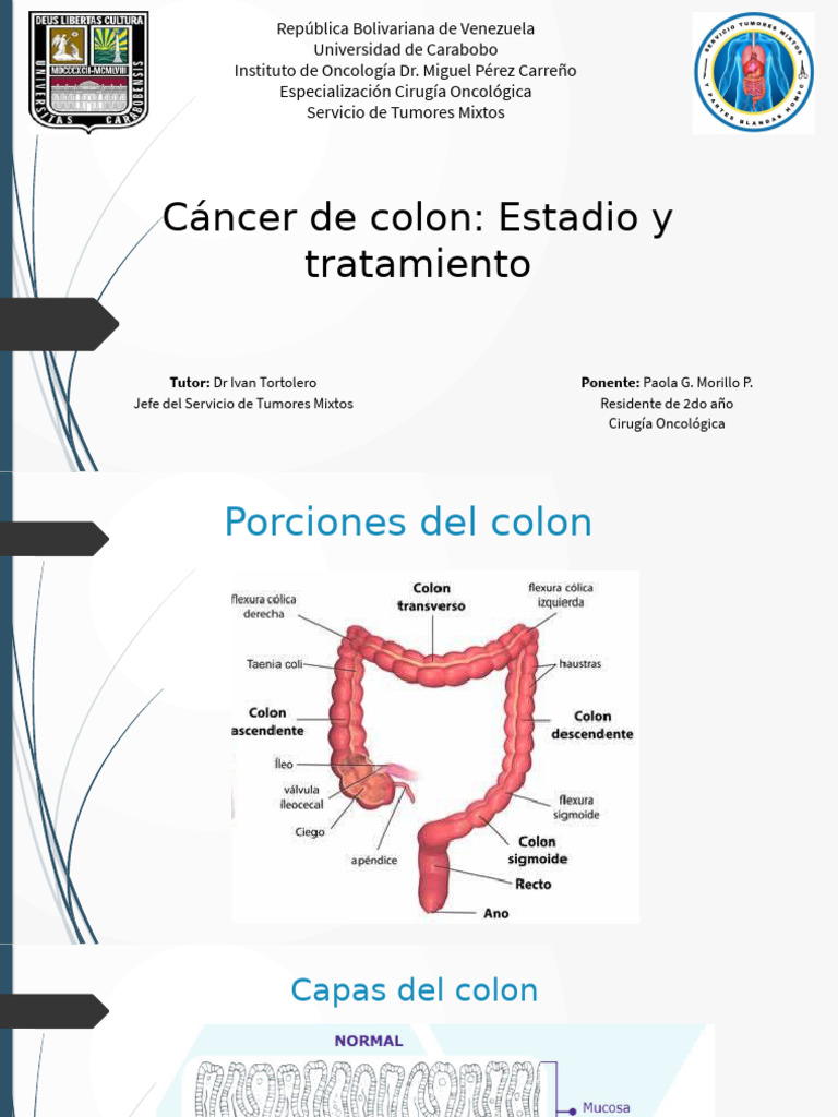 Cancer de Colon Estadio y Tto | PDF | Cáncer colonrectal | Metástasis