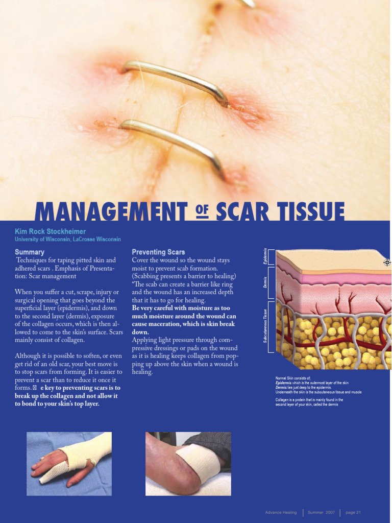 Managment of Scar Tissue | PDF | Diseases And Disorders