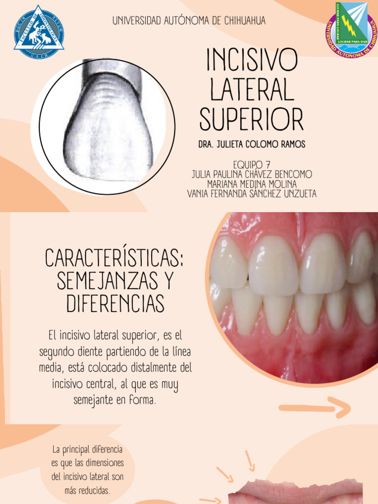 Características del Incisivo Lateral Superior | PDF | Anatomia dental ...