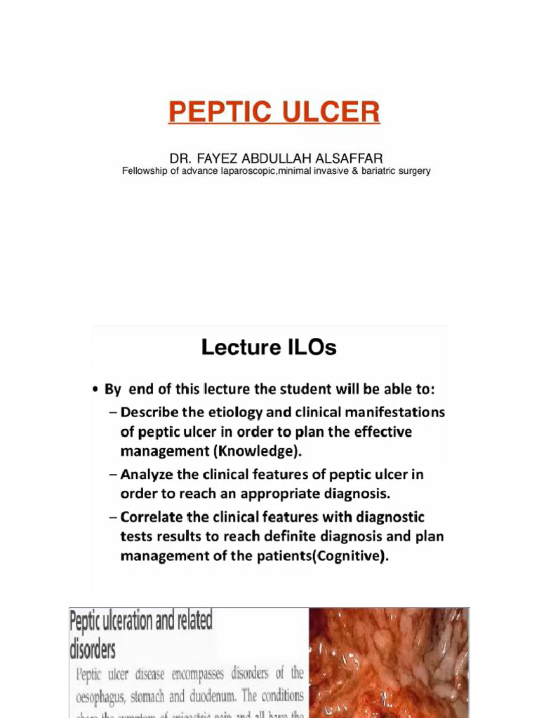 Peptic Ulcer Diseases (Notes) | PDF | Peritoneum | Clinical Medicine