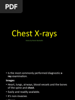 Chest X-Ray Template | PDF | Lung | Thorax