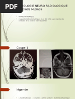 Scanner TDM Thoracique en Coupes | PDF | Aorte | Thorax