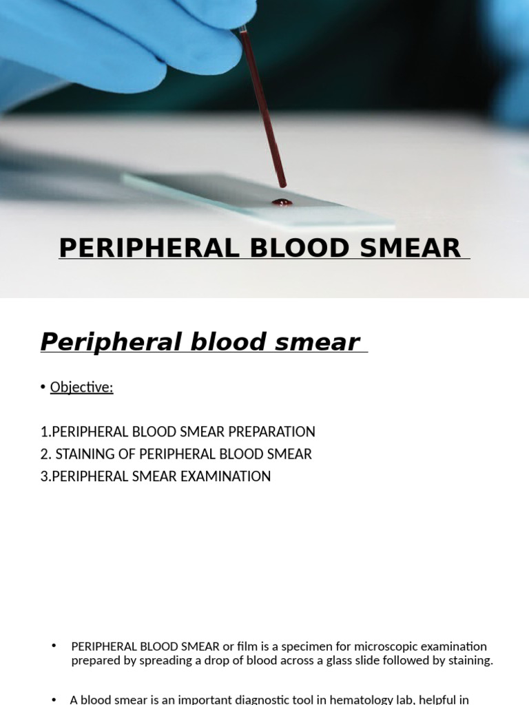 PERIPHERAL BLOOD SMEAR. UGpptx | PDF | Staining | Clinical Medicine