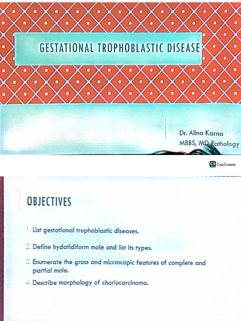 Gestational Trophoblastic Disease .pdf | PDF