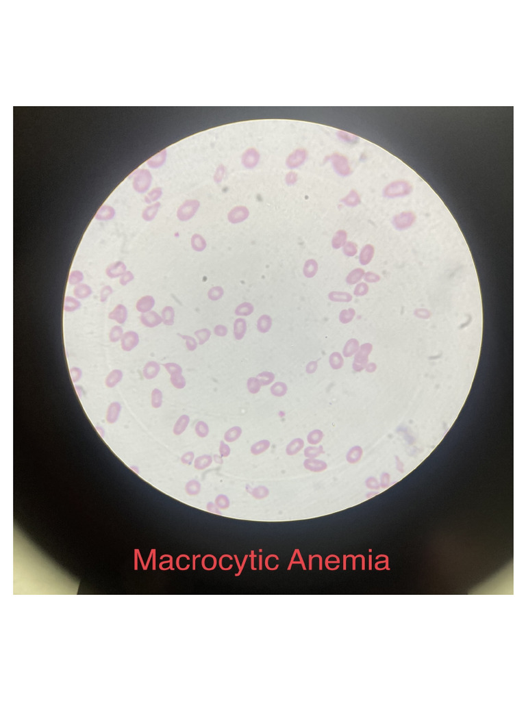 General Pathology Slides | PDF