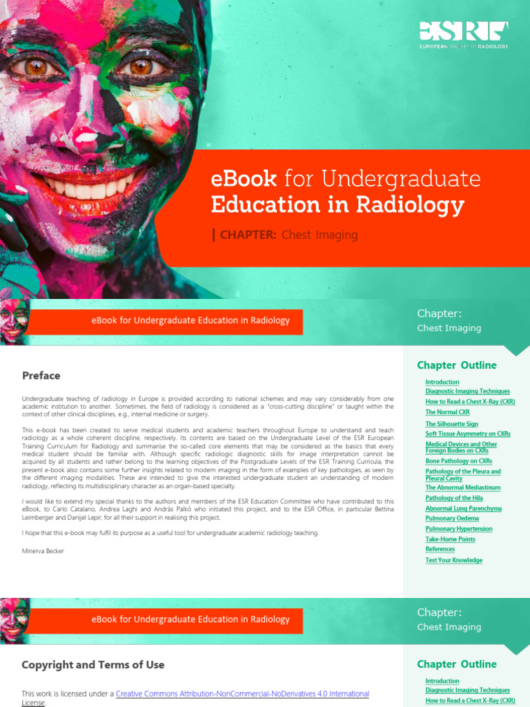 Chest Radiology | PDF | Medical Imaging | Lung