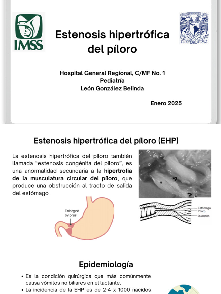 Estenosis hipertrófica del piloro | PDF | Vómitos | Bilis