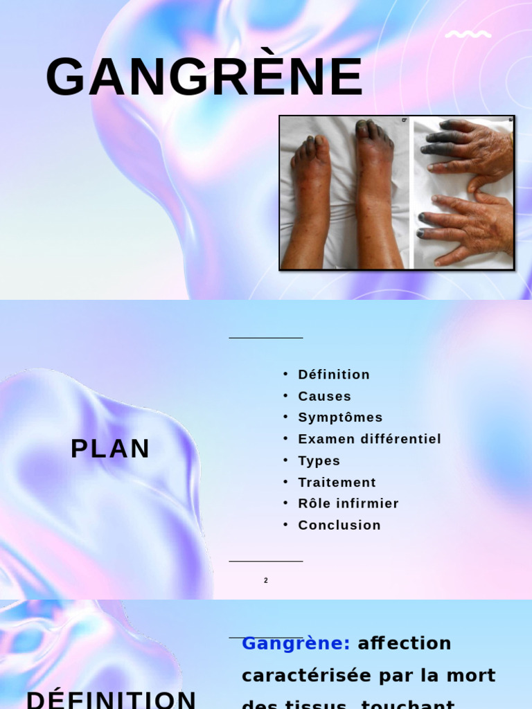 Comprendre La Gangr ne Causes Et Traitements PDF M decine