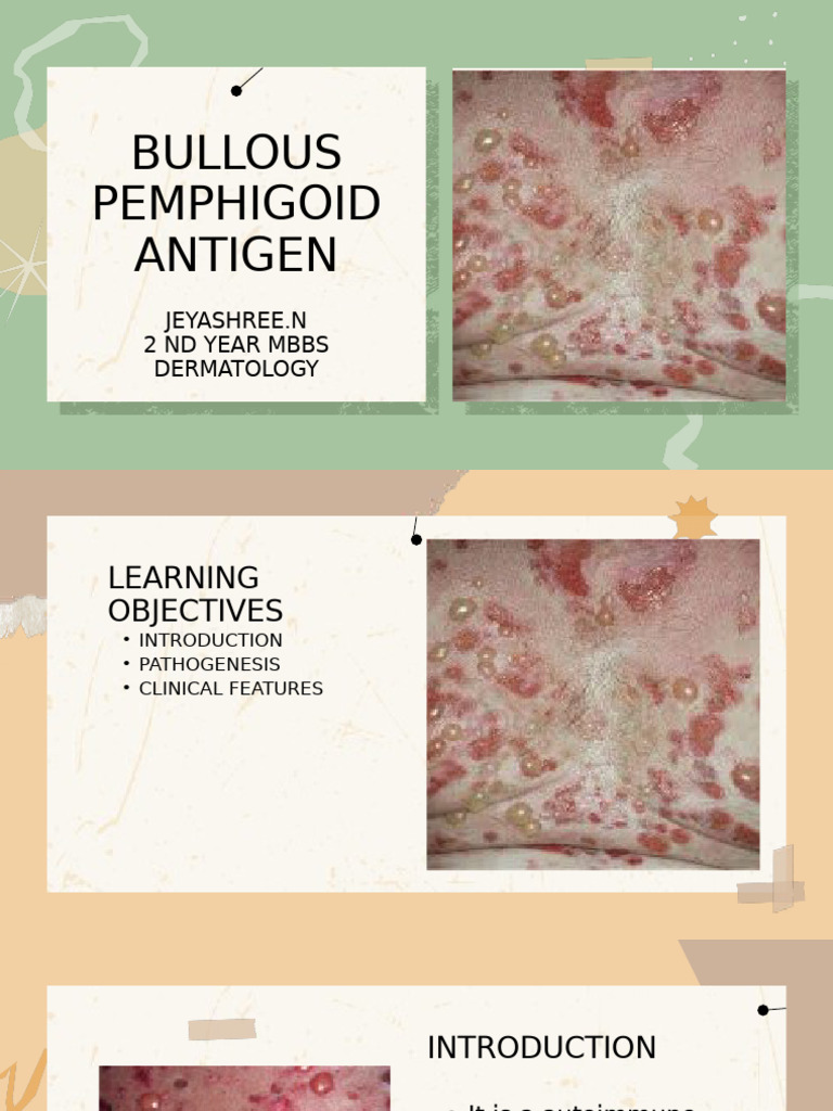 Bullous Pemphigoid Overview | PDF