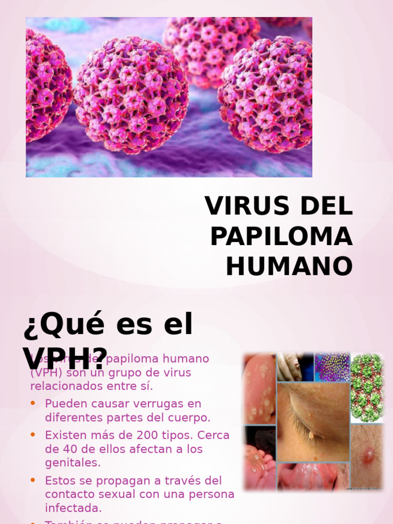 Infecciones por VPH: Riesgos y Tratamientos | PDF | VIH / SIDA | VIH