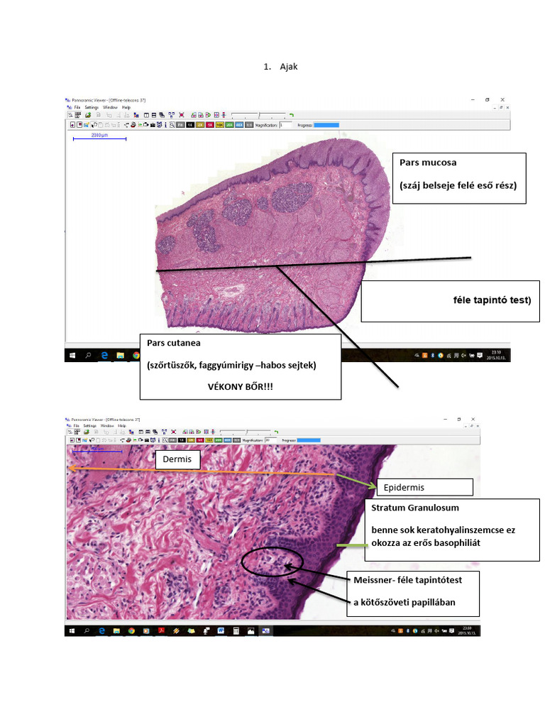 Kidolgozott Metszetek KAnna | PDF