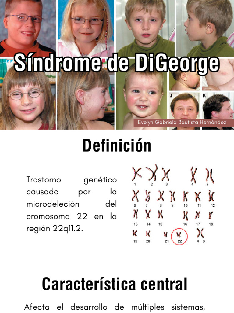 Síndrome de DiGeorge | PDF | Autoinmunidad | Sistema inmune