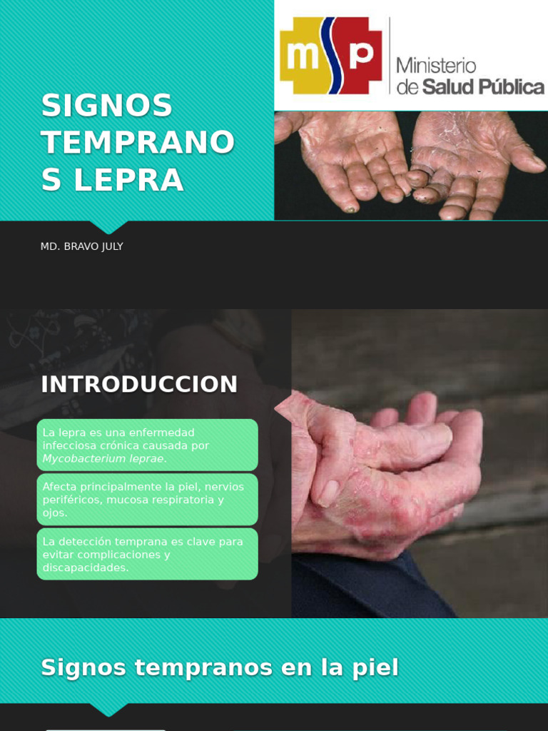 LEPRA | PDF