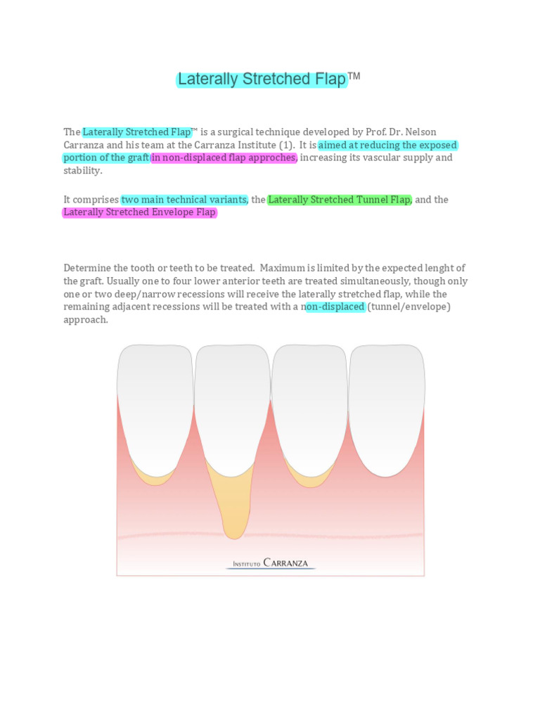 Carranza Laterally Stretched Flap | PDF | Surgical Suture | Grafting