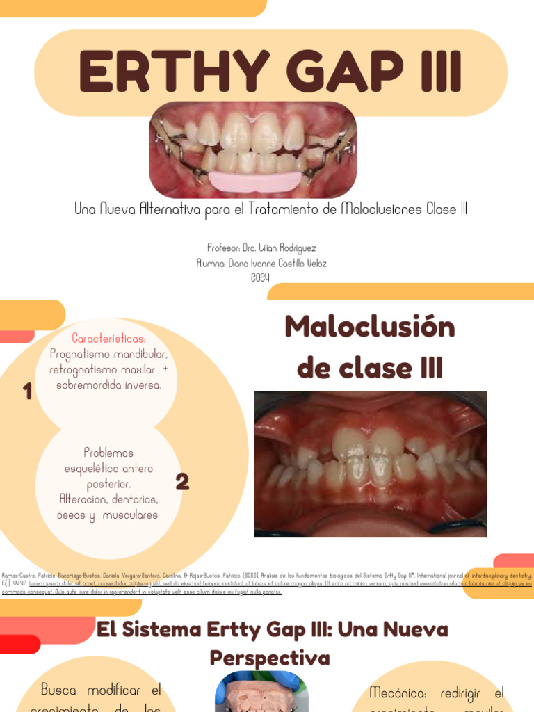 Ertty Gao III Diana Castillo | PDF | Anatomia dental | Diente