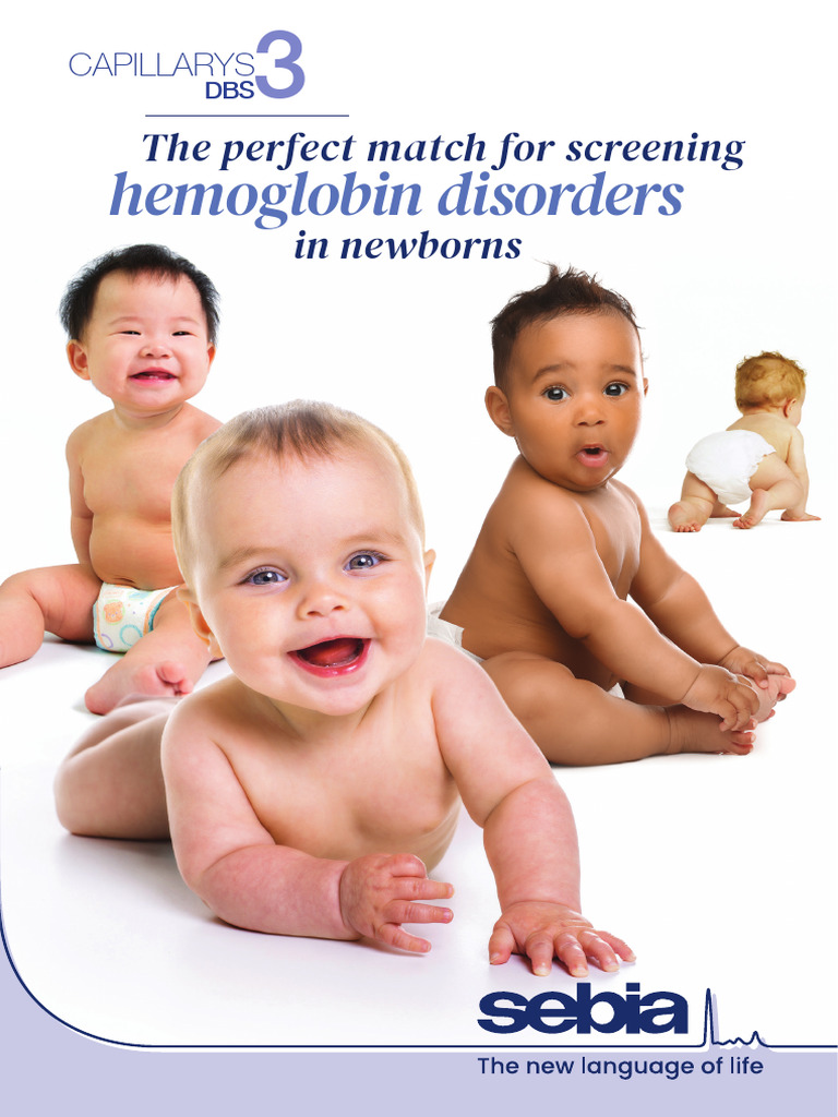 C3 DBS Brochure C3DBSB1EN Page Bojana | PDF